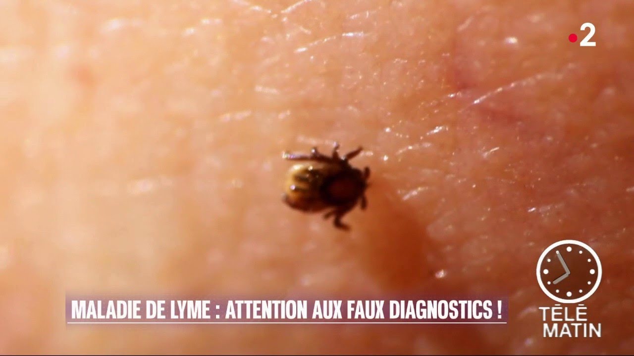 Maladie de Lyme et prévention des piqûres de tiques - La Clinique ...